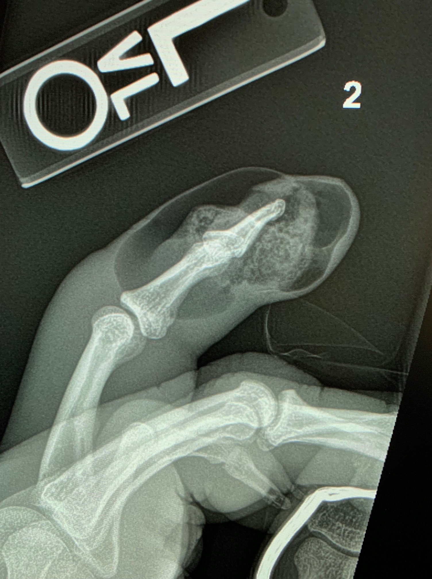 “Badfinger” – Great Exudations